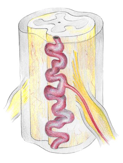 Arteriovenöse Fistel Avf Neurochirurgische Klinik Klinikum Stuttgart