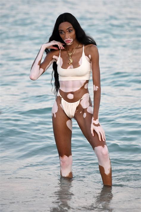 Winnie Harlow Latest Photos Celebmafia