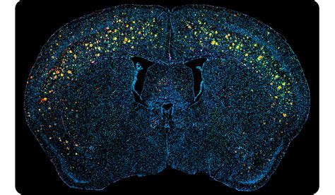 β Amyloid Transgenic Models Of Alzheimers Disease Appps1 Models Biospective
