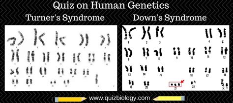 Quiz On Human Genetics Genetics Quiz