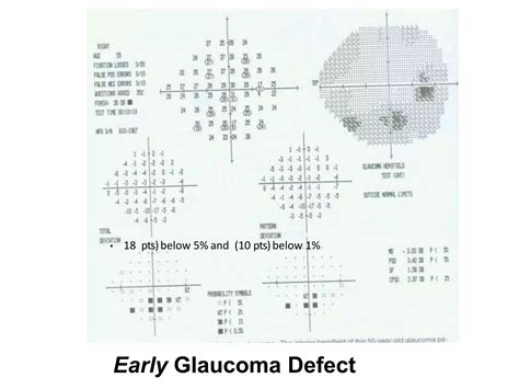 Perimetry Pptx Eye And Vision Conditions Diseases And Conditions