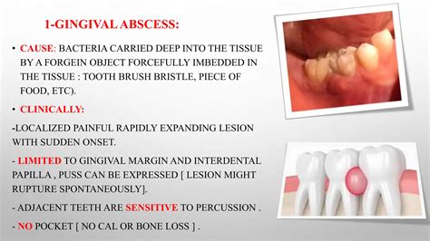 Periodontal Abscesspptx