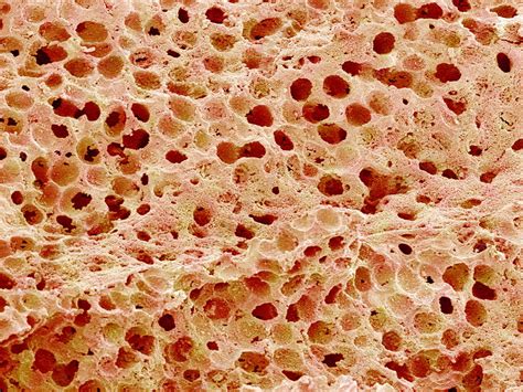 Bone Tissue Sem Stock Image P105 0184 Science Photo Library