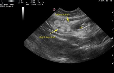 Bilateral Cataracts And Right Eye Uveitis In A 11 Year Old Fs Chihuahua