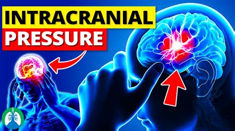 Intracranial Pressure Icp Quick Explainer Video Youtube