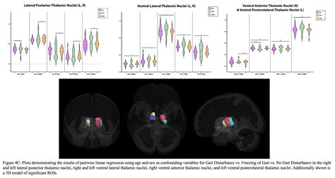 Assessing Gait Disturbances In Parkinsons Disease Using Multi Spectral