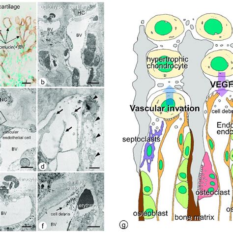 Vascular Endothelial Cells At The Chondro Osseous Junction A