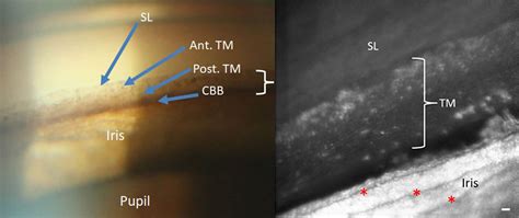 Image Of Trabecular Meshwork Captured For The First Time Insight