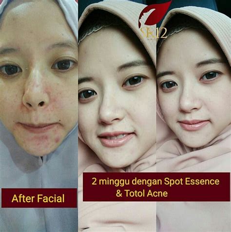 Testimoni Sr12 Skin Care