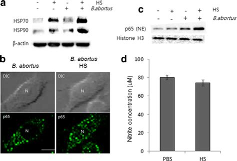 Heat Stress Accelerated Heat Shock Protein Expression And Nf κb