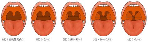 Clinical Diagnosis And Strategies For Early Orthodontic Treatment Of Class Ⅲ Malocclusion With