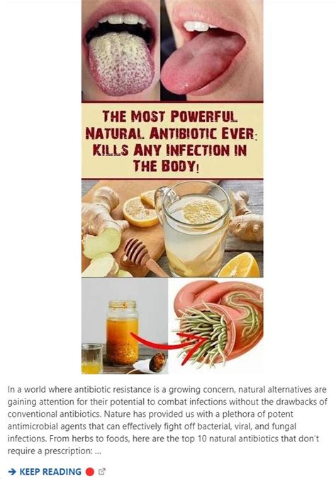 Dereje Taddesse Posted On Linkedin