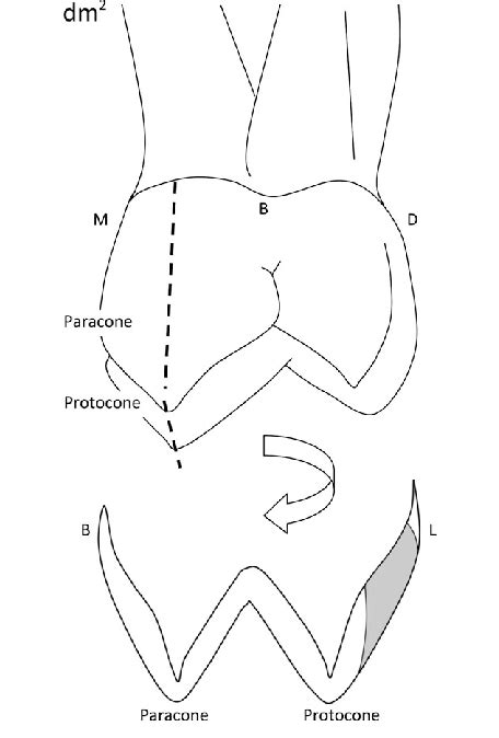 Plane Of Section Through A Deciduous Maxillary Second Molar And