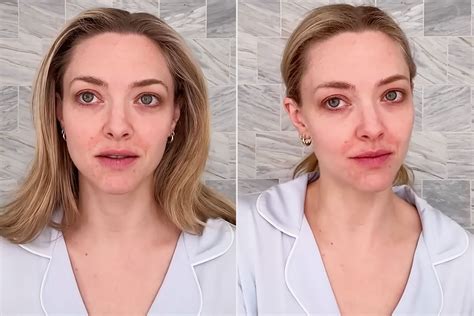 Fans Praise Amanda Seyfried For Being ‘so Real While Showing Makeup Free Face With Eczema