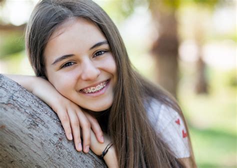 All You Need To Know About Braces Before You Get Them F And B Recipes
