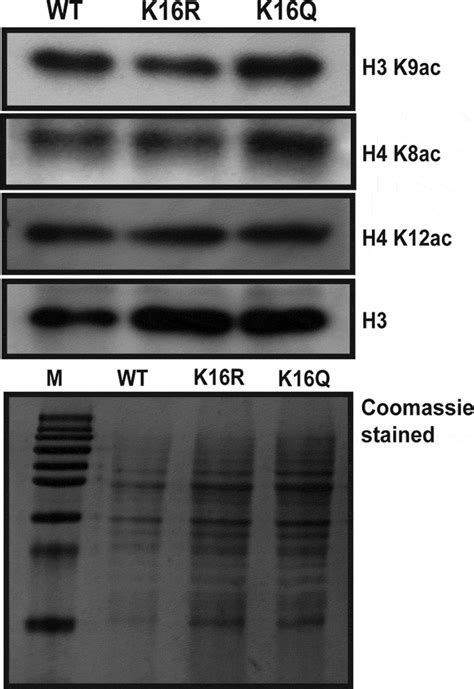 Deacetylation Of H4 Lysine16 Affects Acetylation Of Lysine Residues In