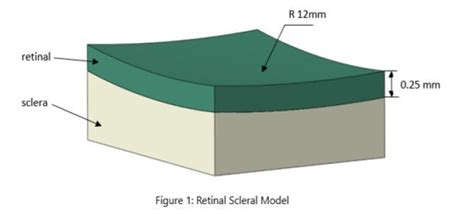 Force Mapping Of Tractional Retinal Detachments With Optical Coherence Tomography Biomedgrid Llc