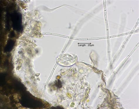 Ciliaphora A Planktonistas World