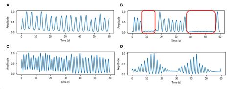 Figure 6 From A Real Time Respiration Monitoring And Classification System Using A Depth Camera