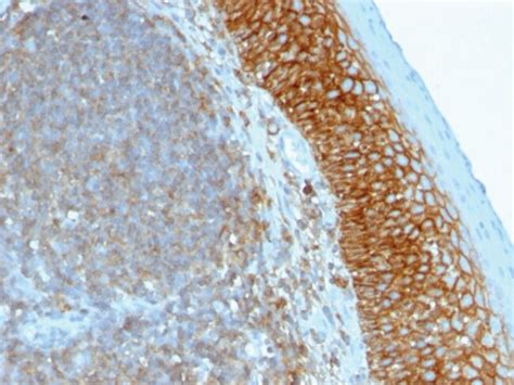 Cd44 Hcam Mouse Clone Spm544 Enquirebio™ 100 μg Fisher Scientific