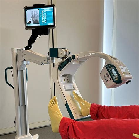 Smart C Mini C Bogen Präzise Diagnosen Von Hand Und Fuss Swissray