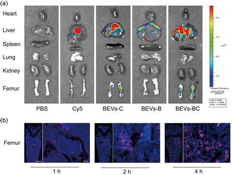 Synthetic Biology‐based Bacterial Extracellular Vesicles Displaying Bmp