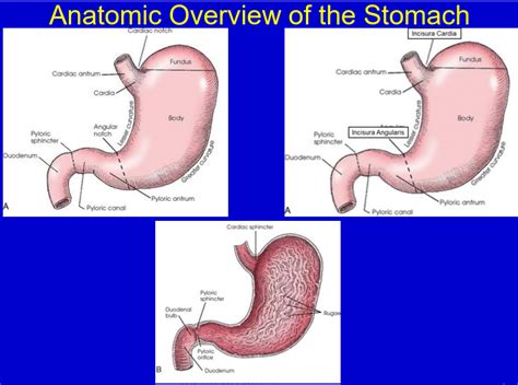 Cardiac Notch Stomach