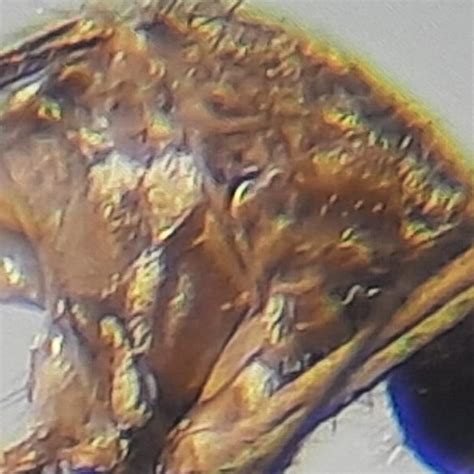 Mesepimeral Setae Absent Lower Proepisternal Scales Present Download Scientific Diagram