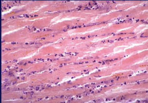 Lecture 1 4 Necrosis Apoptosis And Pathologic Calcification Star ⭐️ Flashcards Quizlet