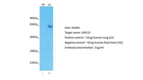 Lrrc15 Polyclonal Antibody Pa5 113927