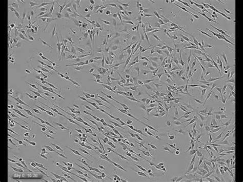 B16 F1 Melanoma Cells On Protein Micropatterned Lines Youtube