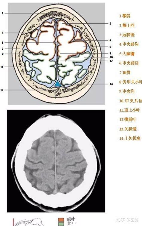 小儿头部外伤有必要ct检查吗 知乎