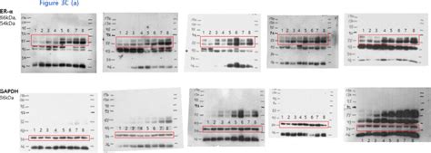 Sex Differences In Inflammation Correlated With Estrogen And Estrogen