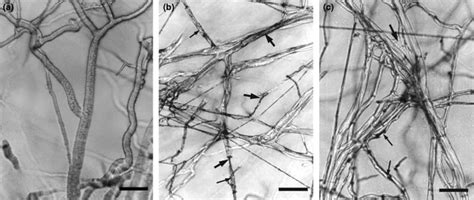 Effect Of Essential Oils On Hyphal Morphology Of S Sclerotiorum Under Download Scientific