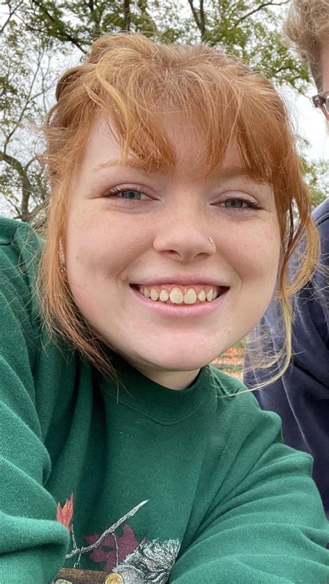 Guess Who Got Her Braces Off Today R Braces