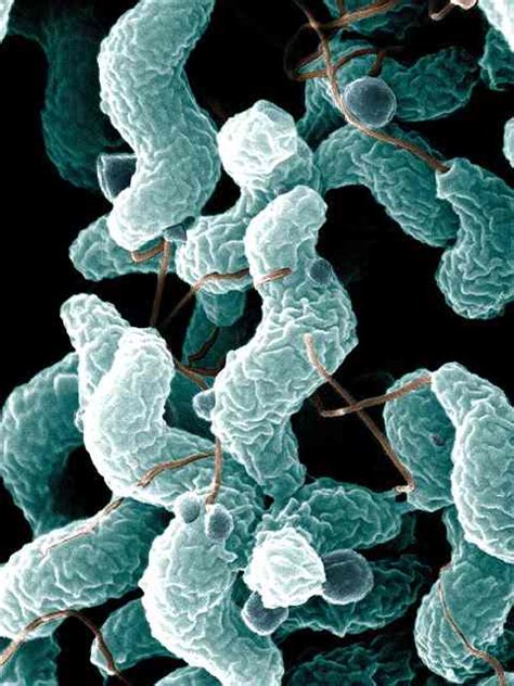 Campylobacter Bacteria Gastroenteritis And Foodborne Illness Hubpages