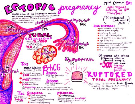Emergency Medicine Educationobcast Ectopic Pregnancy Emergency