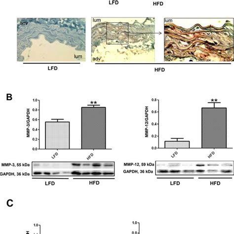 Histological Sections From Human Aortic Aneurysmal Tissue Download