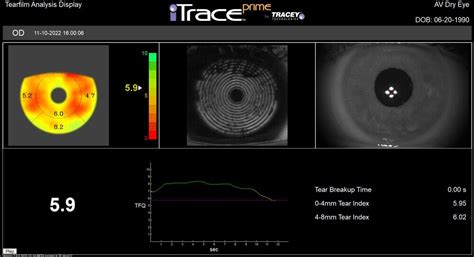 Itrace Prime Tracey Technologies
