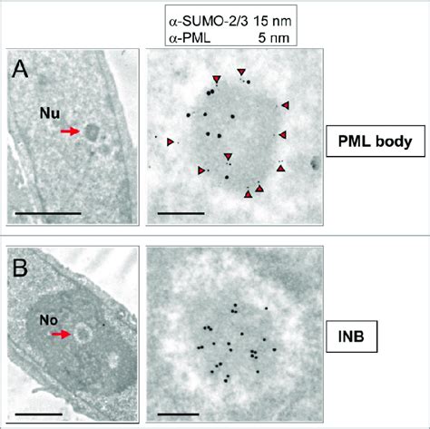 Inbs Are Distinct From Pml Bodies As Shown By Differential Pml And