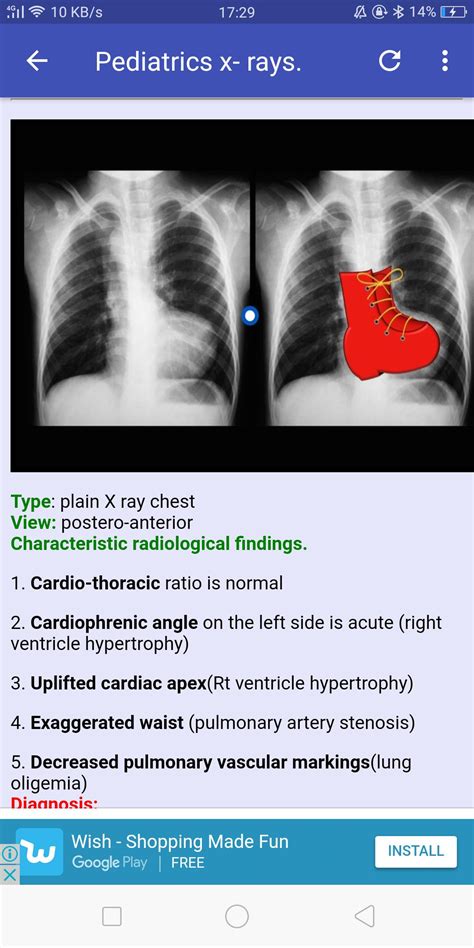 Pediatric Mnemonics Apk For Android Download