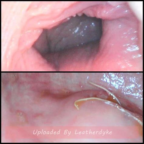Extreme Anal Dilation And Anal Fisting New Page 828