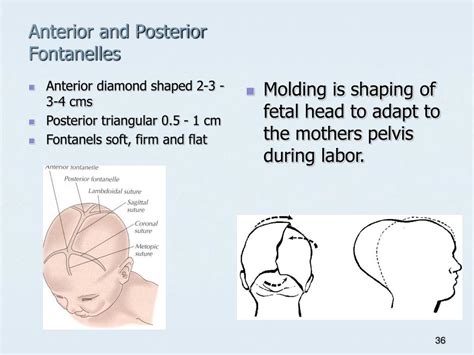 How To Check Anterior Fontanelle At Neomi Ingram Blog