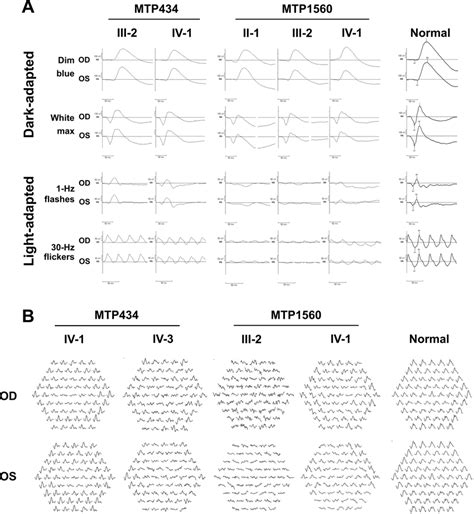 Full Field Electroretinography Fferg And Multifocal Erg Mferg Of Download Scientific