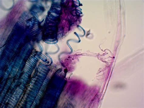 What Is The Difference Between Protoxylem And Metaxylem Pediaacom