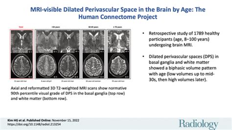 Mri Visible Dilated Perivascular Space In The Brain By Age The Human