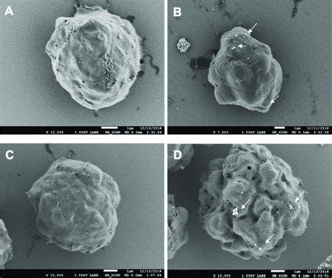 Sem Micrograph Of Radioresistant Ly R And Radiosensitive Cells