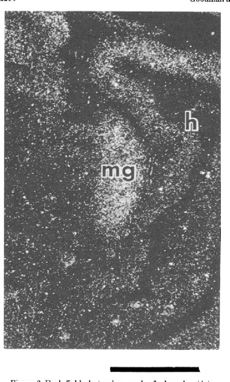 Structure Of Dentate Gyrus Semantic Scholar