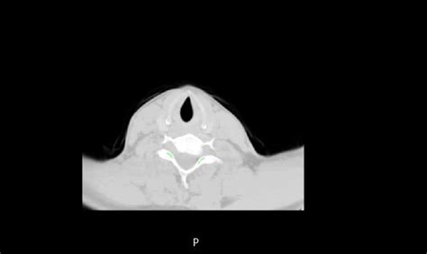 Failed To Execute Script App · Issue 130 · Invesaliusinvesalius3 · Github