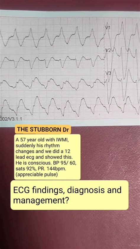 Comment Down Your Diagnosis ⬇️ 👇🏾 Cardiology Ekg Ecg Cardiologia